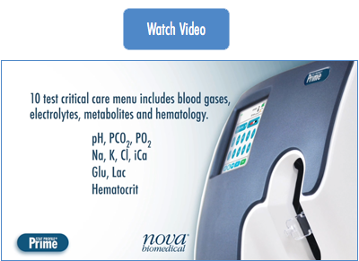 Nova Biomedical : World Leader in Biosensor Technology